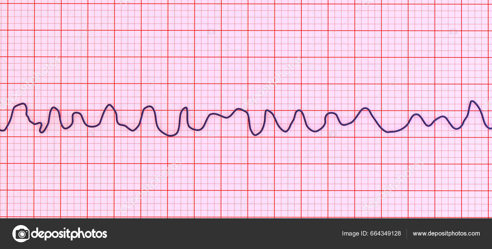 Scientific Illustration Depicting Electrocardiogram Ecg Displaying ...