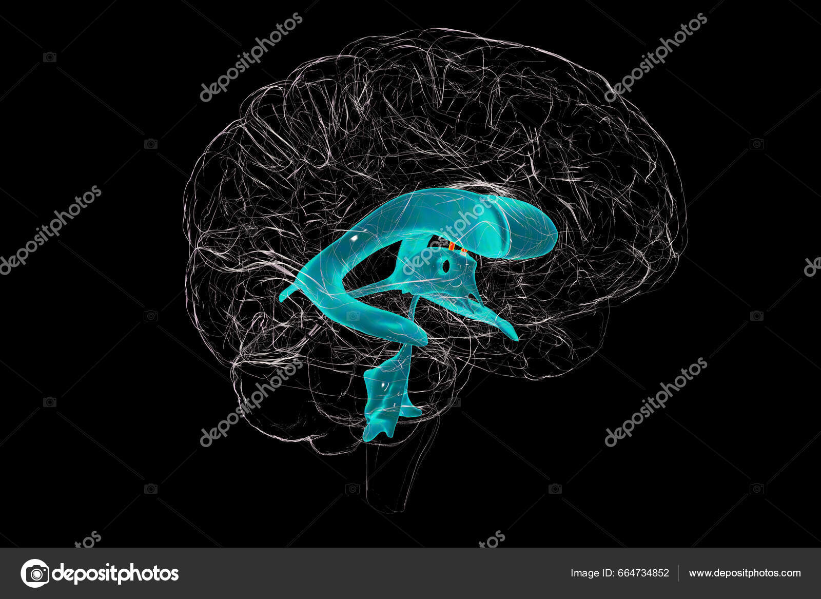 Les Foramen Interventriculaires Les Foramen Monro Passage Qui Relie Les ...