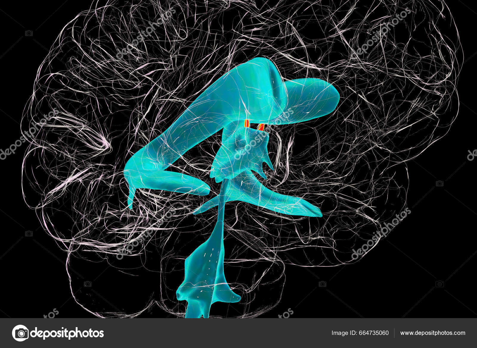 Foramen Interventricular Foramen Monro Paso Que Conecta Los Ventrículos ...