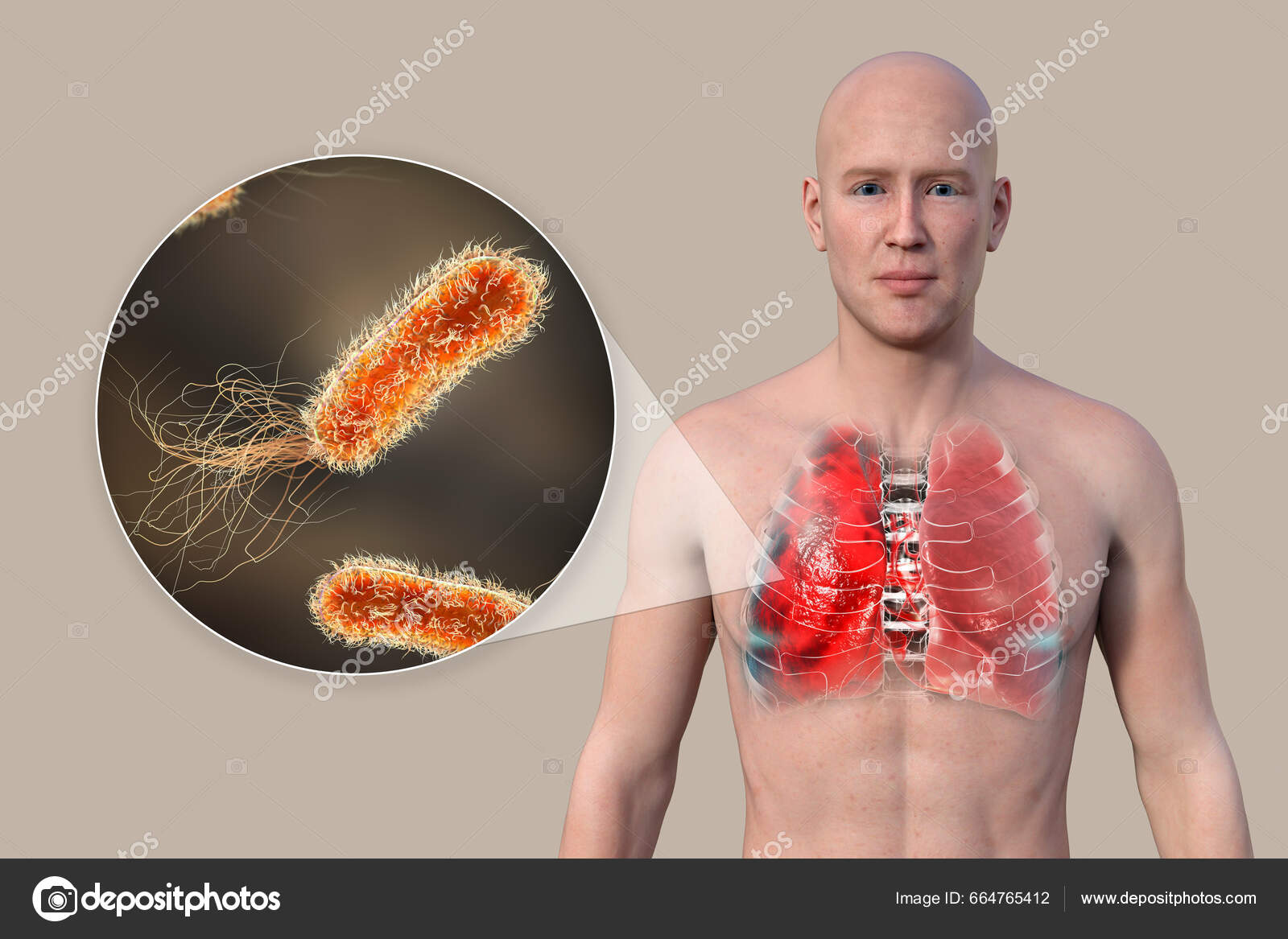 Pseudomonas Aeruginosa Skin