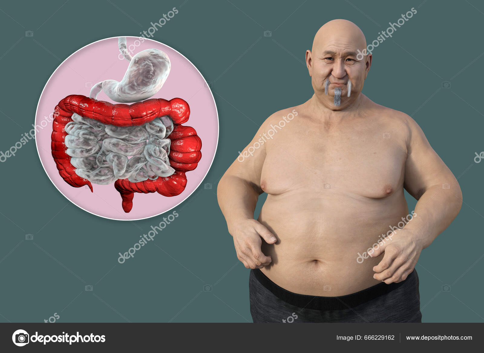 Overweight Man Close View His Digestive System Highlighting Presence ...