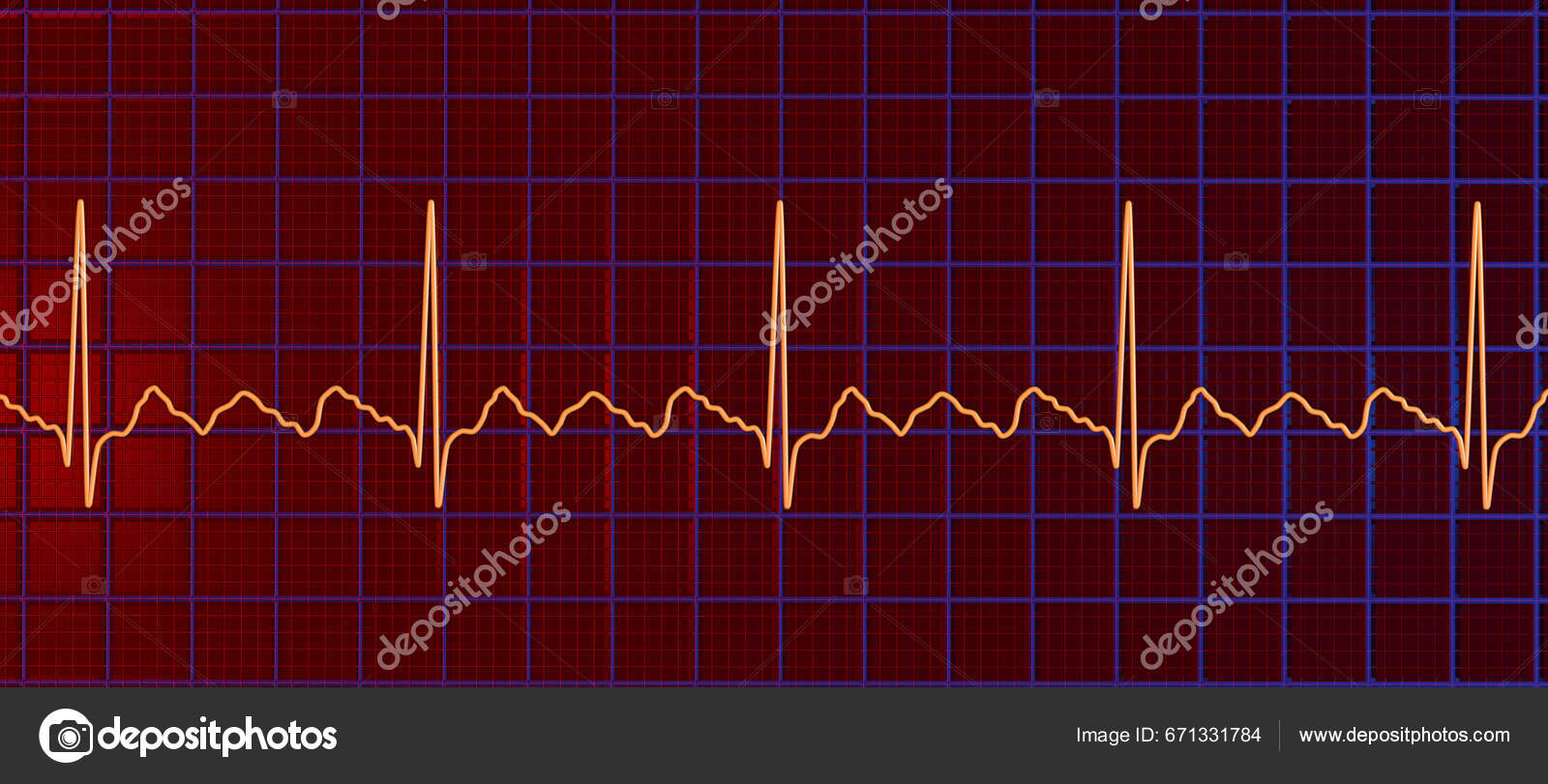 Abnormal Ekg Background Stock Electrocardiography Wikipedia