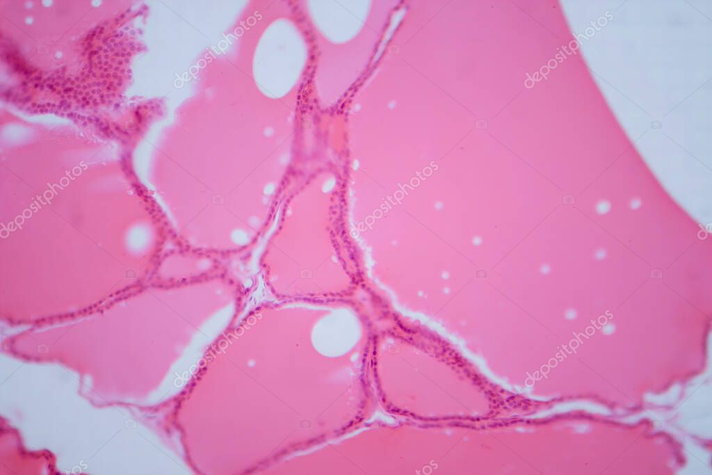 Fotomicrograf a de una gl ndula tiroides normal bajo un microscopio, con estructura folicular t ...