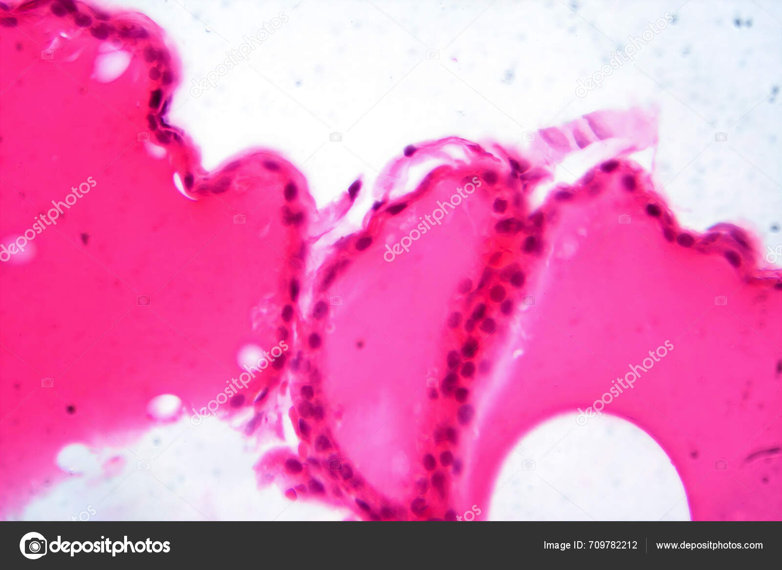 Photomicrograph Normal Thyroid Gland Microscope Exhibiting Typical ...