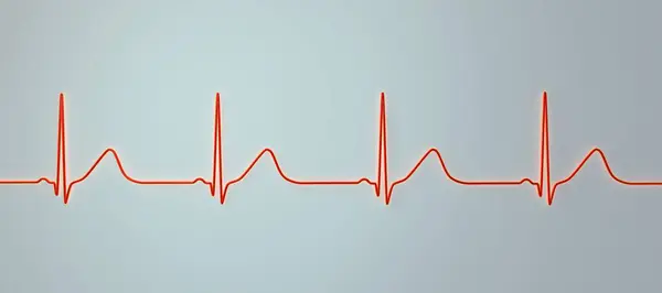 Memes Electrocardiograma