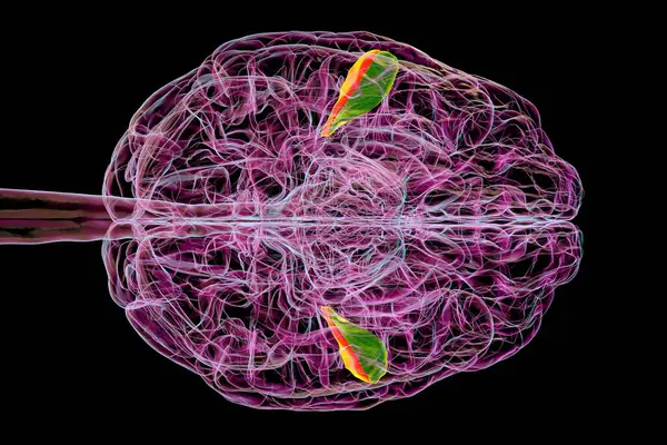 Ilustración 3D de un cerebro humano con el giro temporal transversal ...