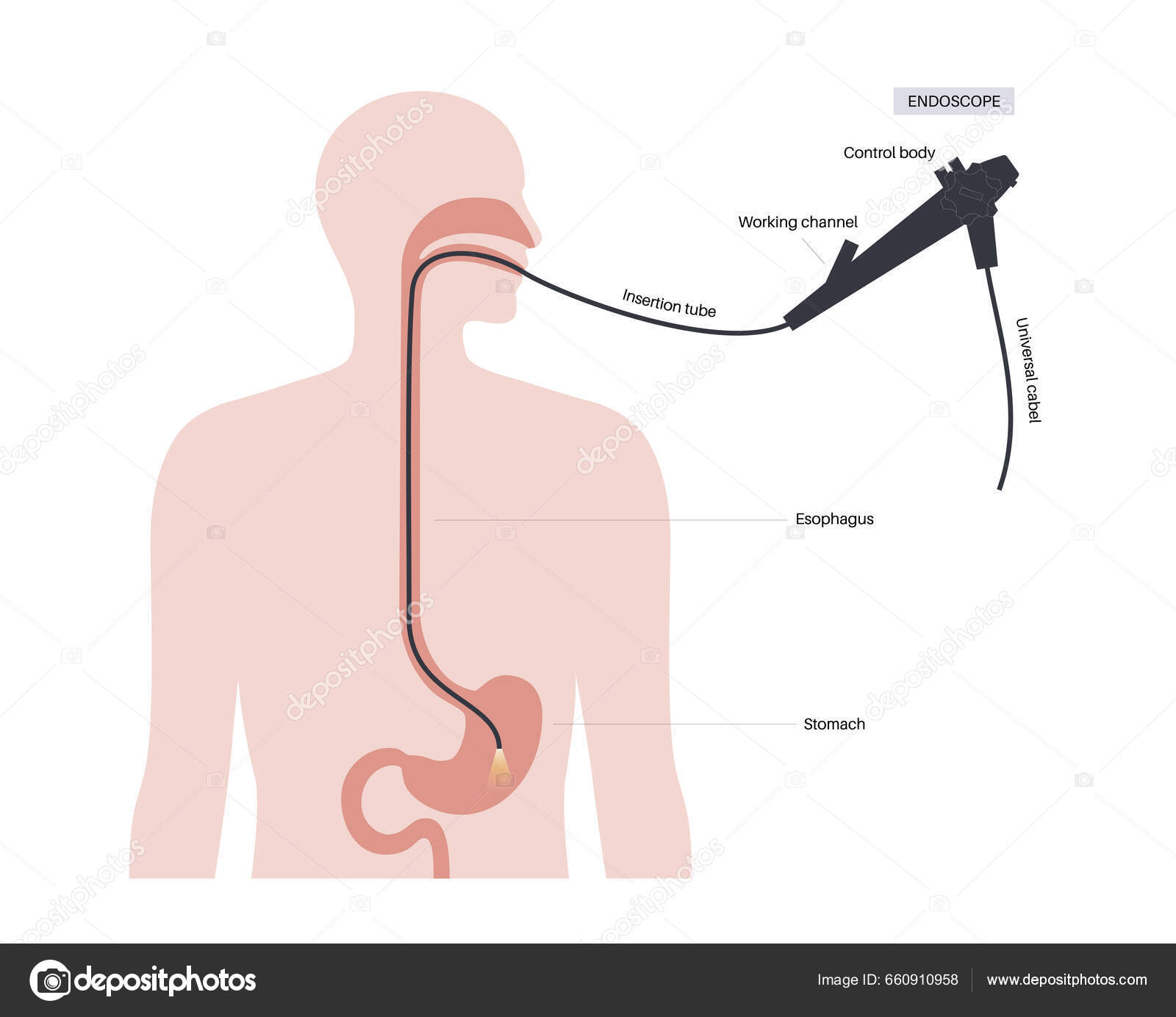 Gastroscopy Procedure Gastroenterologist Uses Gastroscope Endoscopy ...
