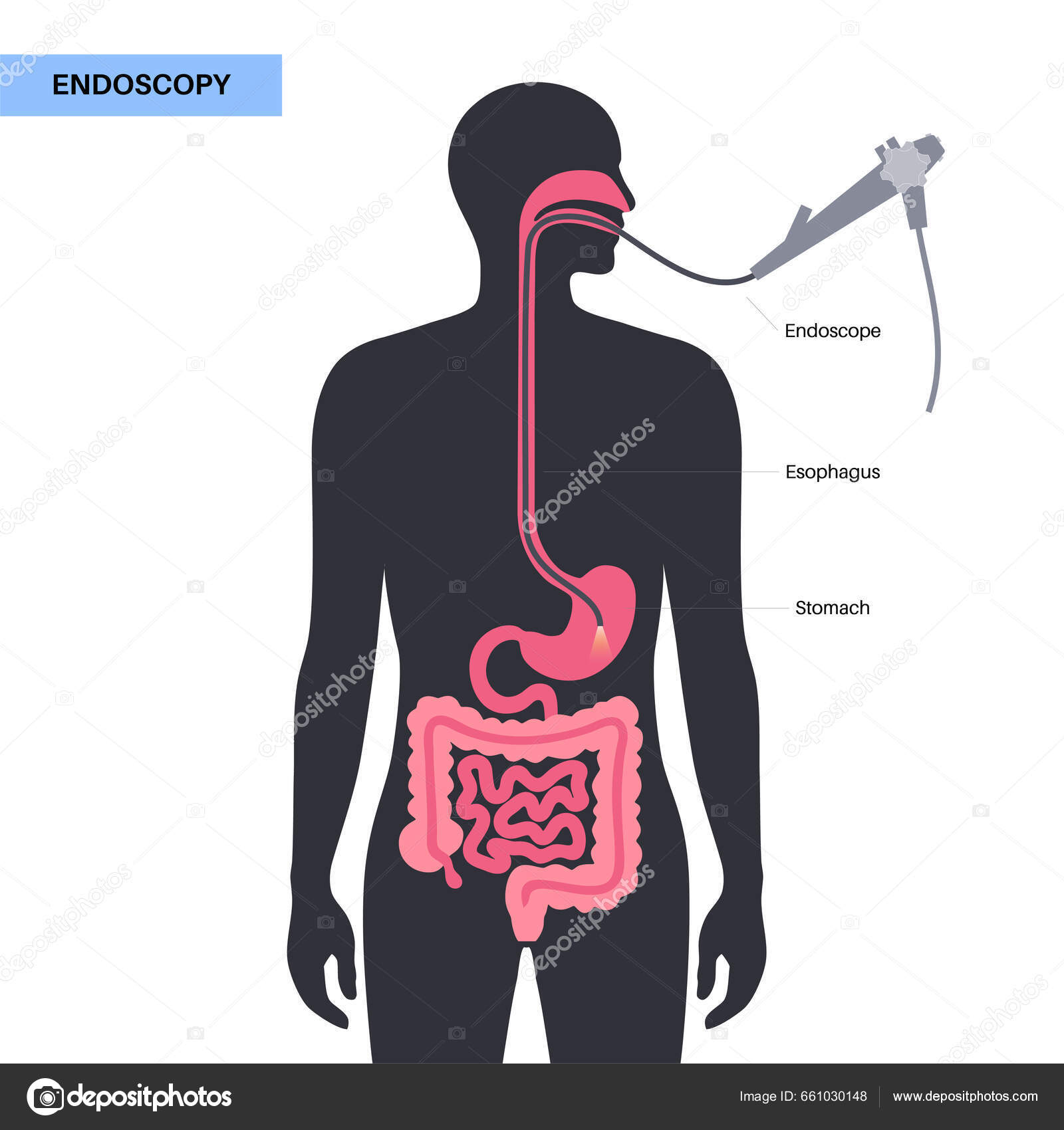 Gastroscopy Procedure Gastroenterologist Uses Gastroscope Stomach ...