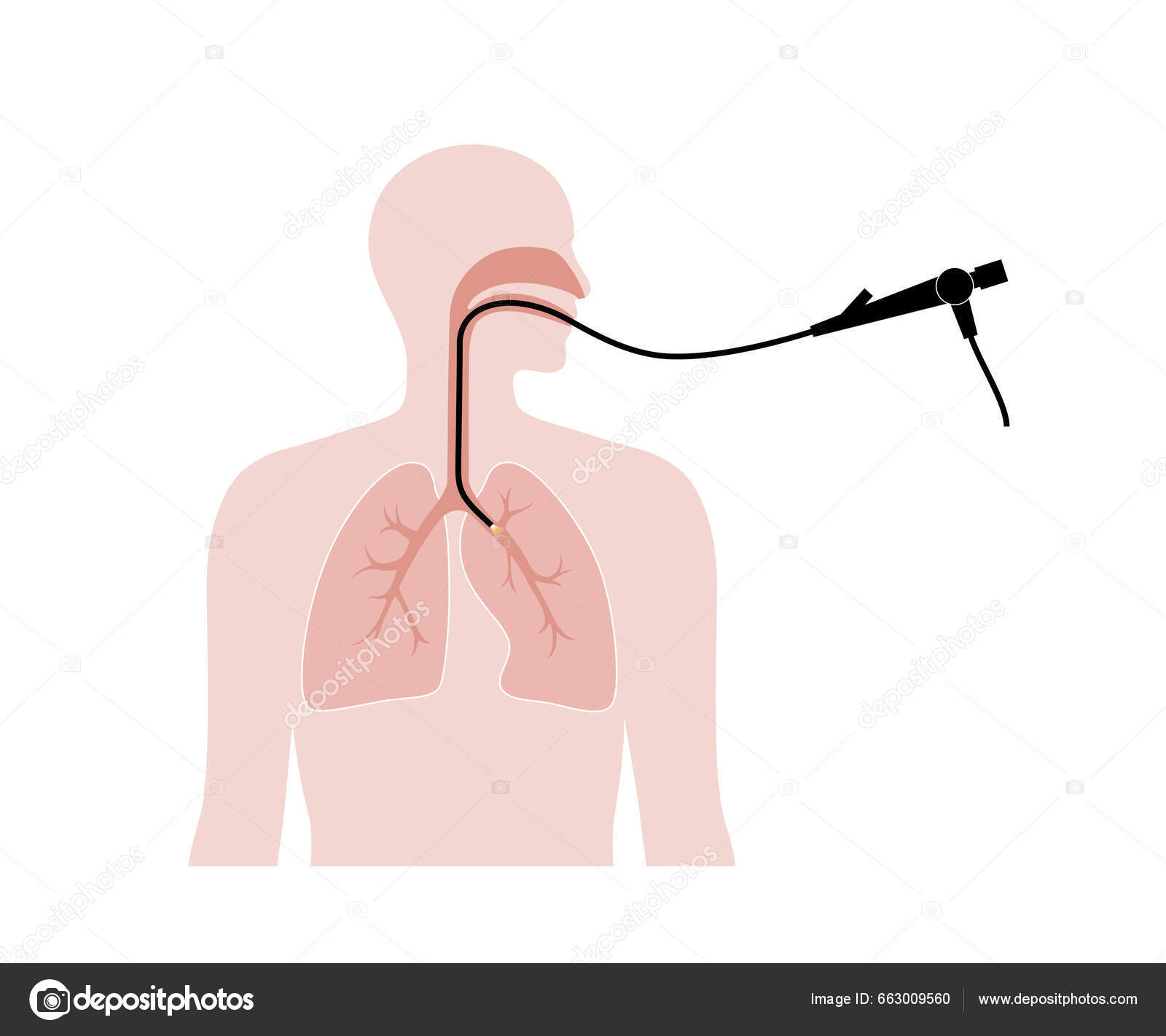 Image vectorielle Procédure Bronchoscopie Pneumologue Utilise ...