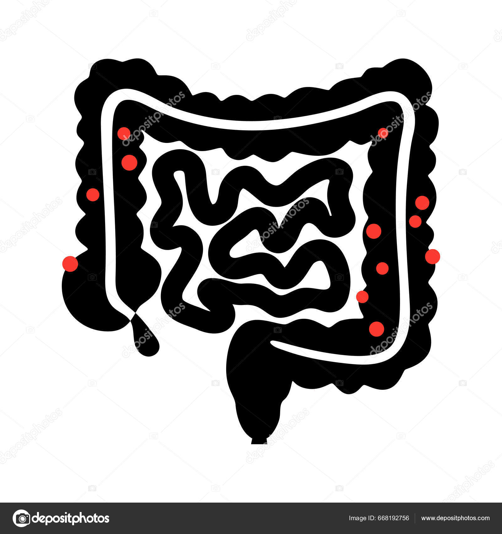 Diverticulite Doenças Diverticulose Divertículos Nas Paredes Intestino ...