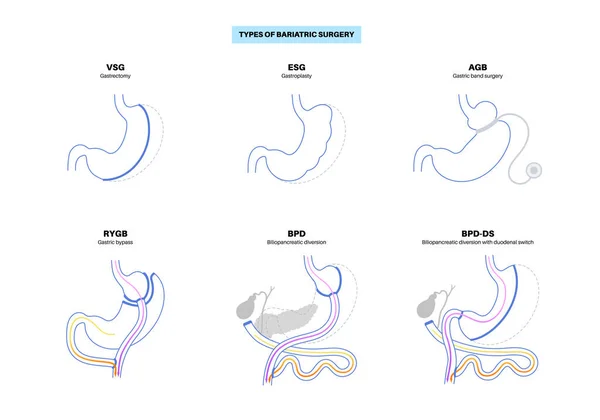 Hormonas intestinales images vectorielles, Hormonas intestinales ...