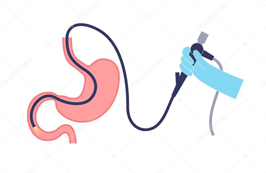 Afiche médico de esofagogastroduodenoscopia. Procedimiento diagnóstico ...