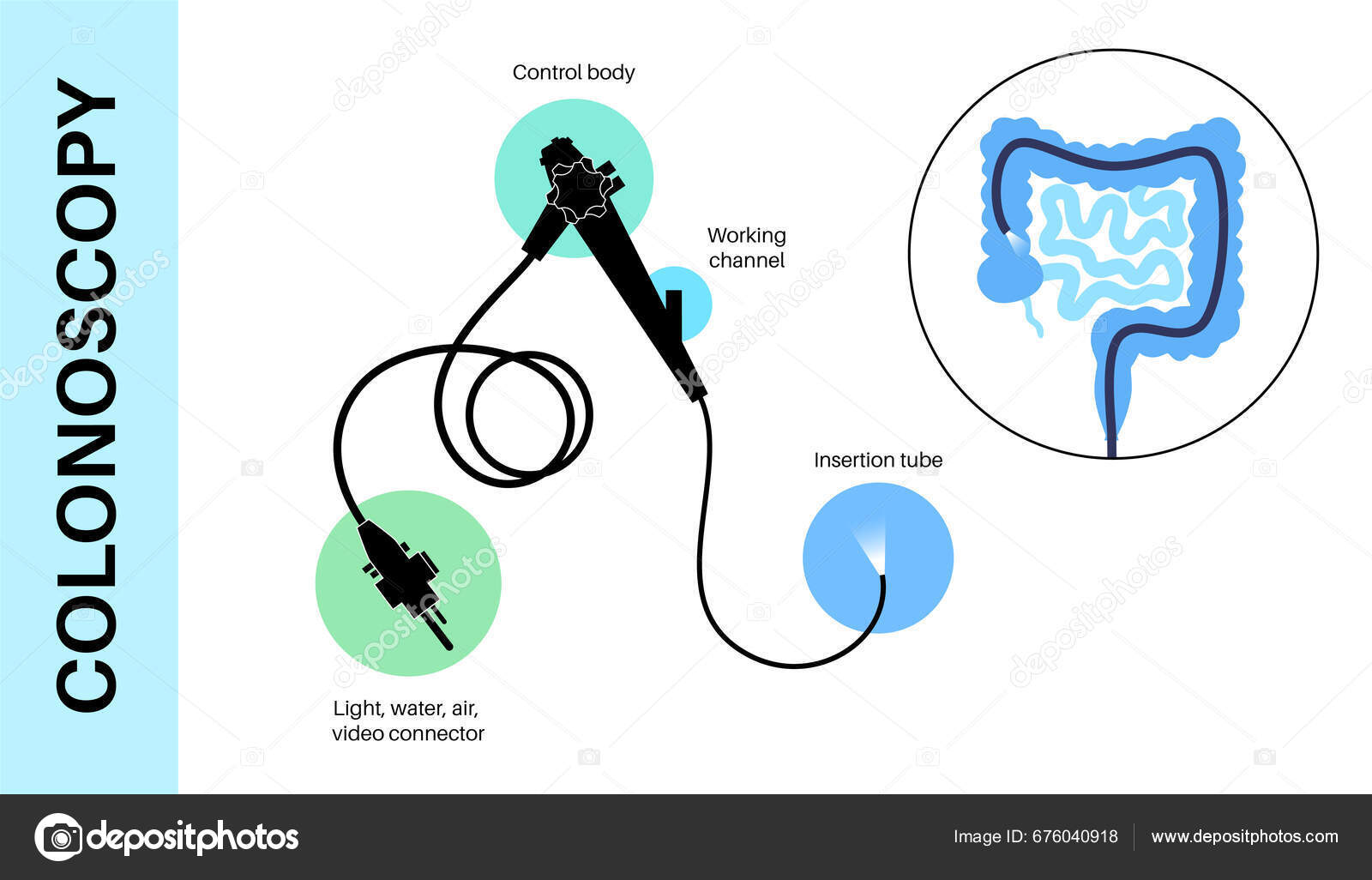 Colonoscopy Minimally Invasive Procedure Examination Treatment Large ...