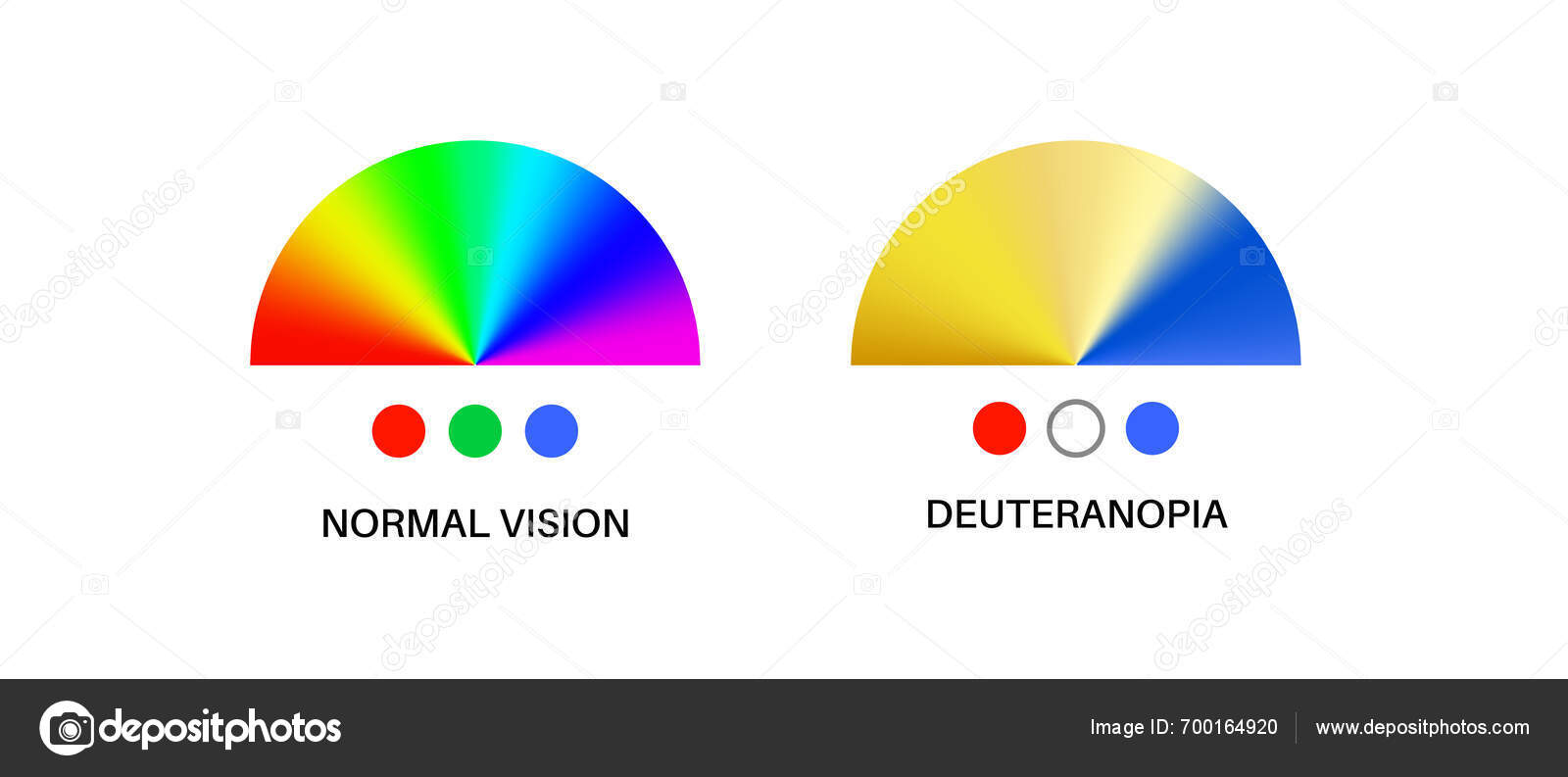 Deuteranopía Visión Normal Infografía Daltonismo Concepto Deficiencia ...