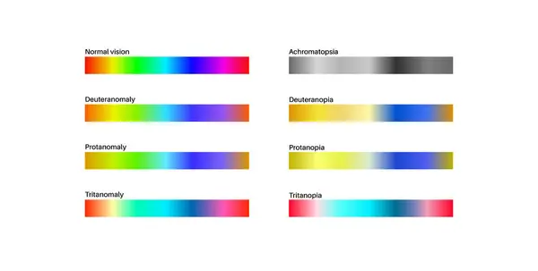 Deuteranopia Normal Vision Color Blindness Infographic Human Vision ...