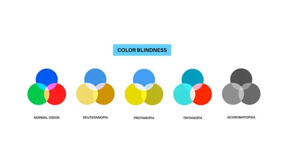 Deuteranopia Normal Vision Color Blindness Infographic Human Vision ...
