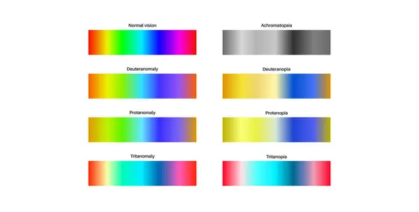 Deuteranopia Normal Vision Color Blindness Infographic Human Vision ...