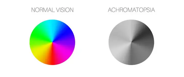 Acromatopsia y visión normal, infografía de daltonismo. Concepto de ...