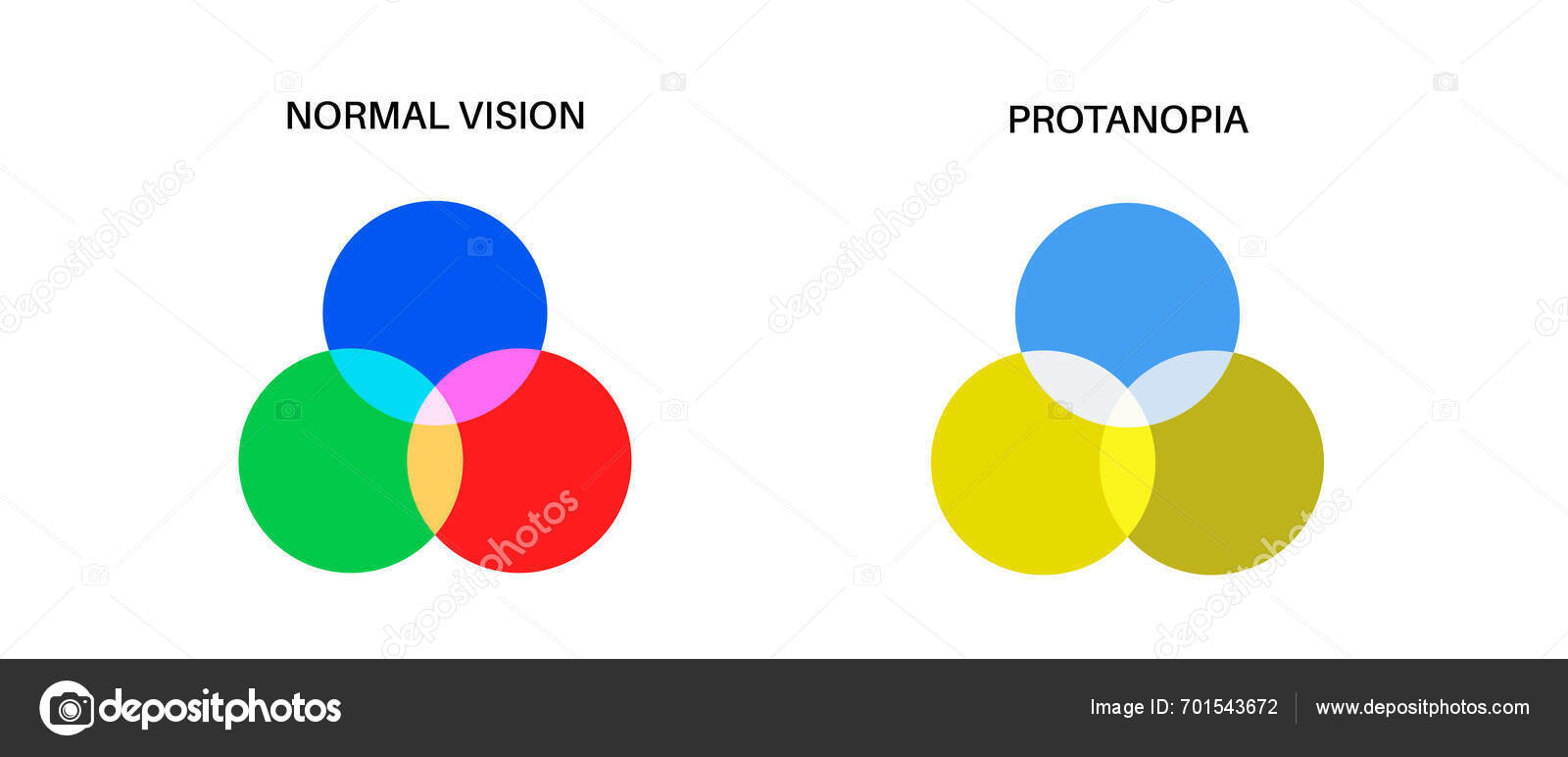 Visión Protanopía Infografía Daltonismo Concepto Deficiencia Visión ...