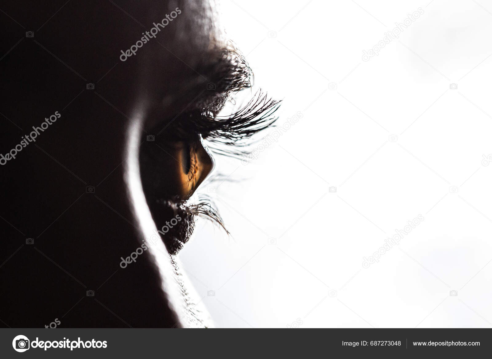 Macro Brown Woman Eye Suffering Keratoconus Cone Shaped Deformation ...