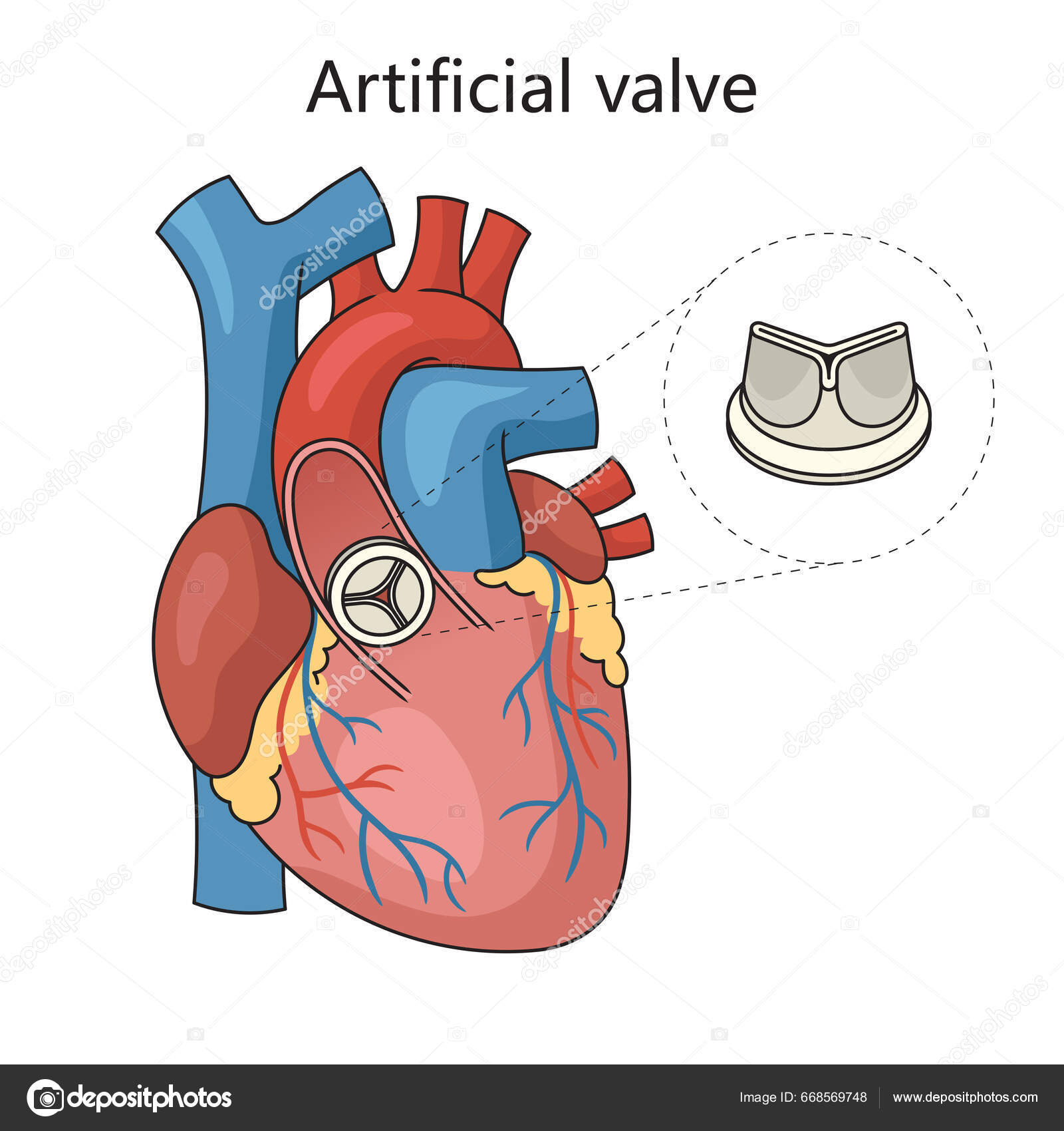 Diagrama De Valvulas Cardiacas Rotulado