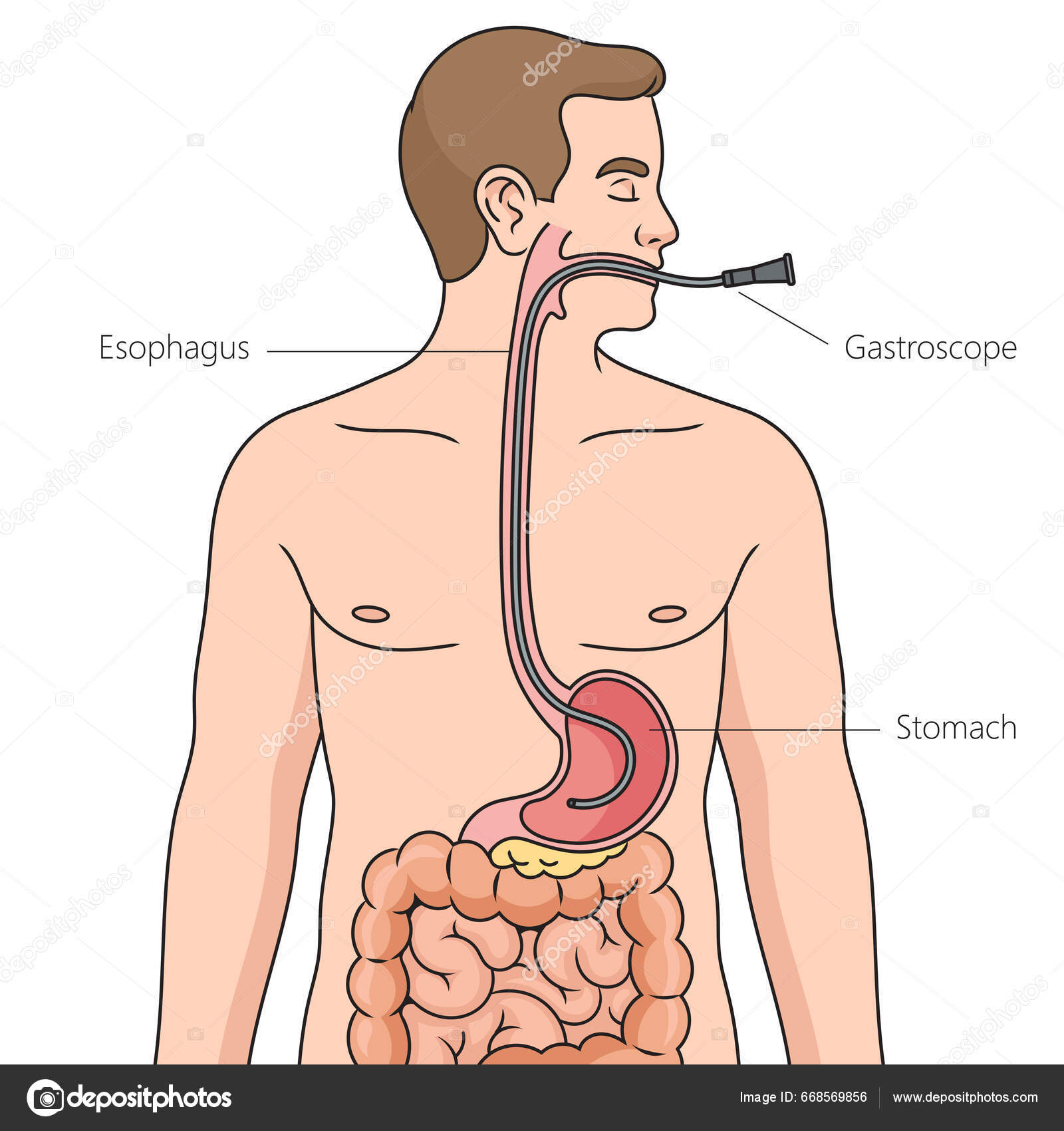 Diagramm Der Nasogastrischen Intubation Schematische Vektordarstellung Pädagogische Illustration ...