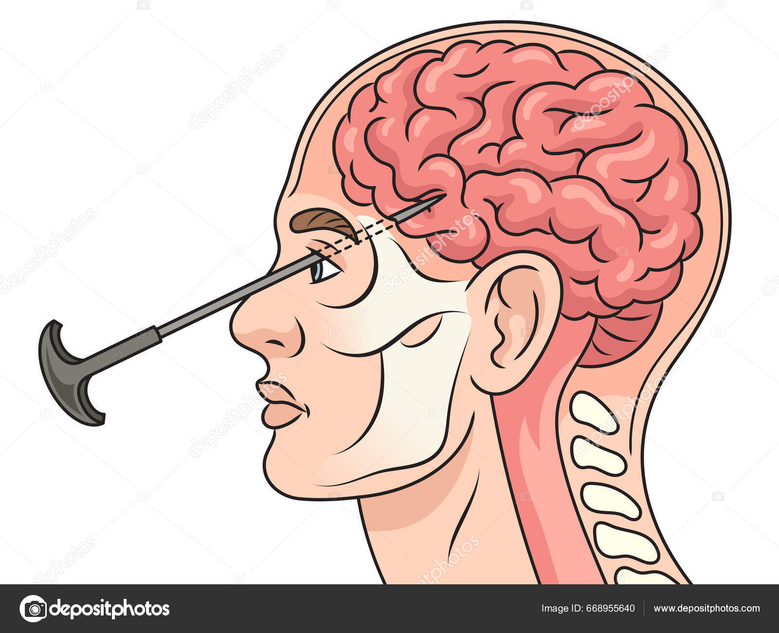 Hjernediagram Merket