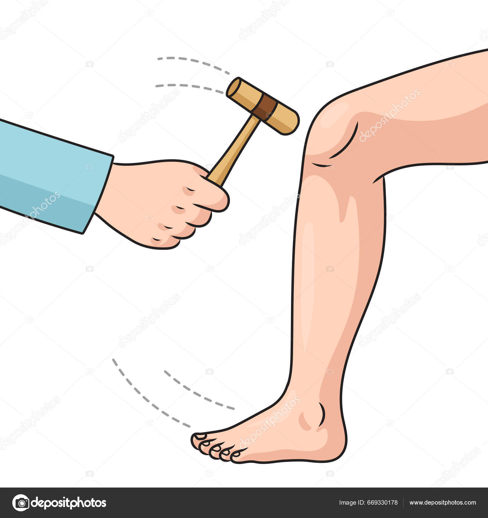 Dokter Memeriksa Refleks Patellar Dengan Gambar Vektor Skematik Palu ...