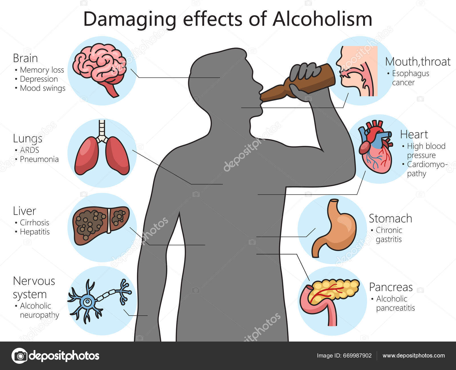 Harmful Effects Alcohol Human Body Diagram Schematic Vector ...