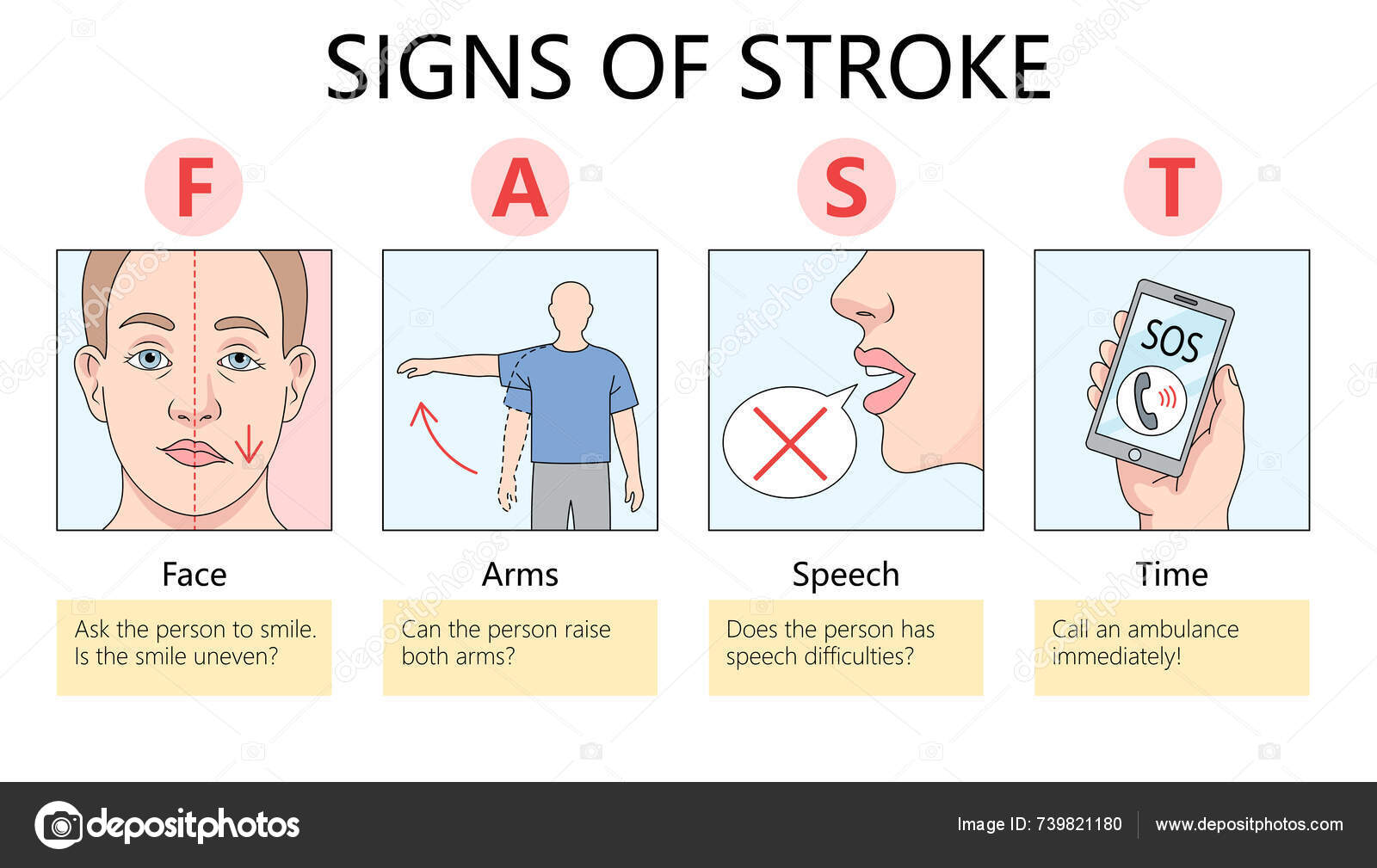 Infographic Showing Fast Stroke Signs Facial Droop Arm Weakness Speech ...