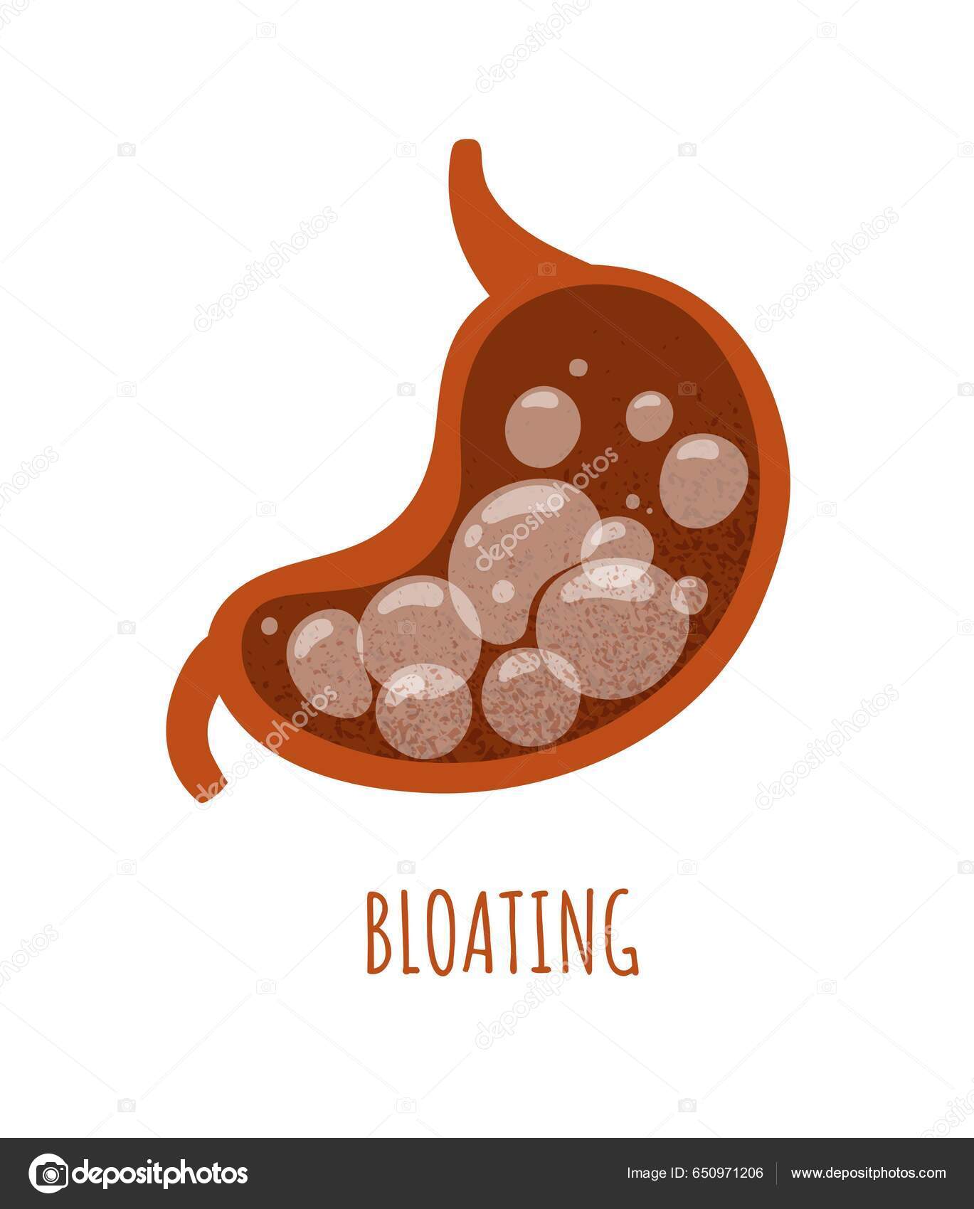 Conceito Estômago Inchado Bolhas Gás Nos Intestinos Infográfico Médico ...