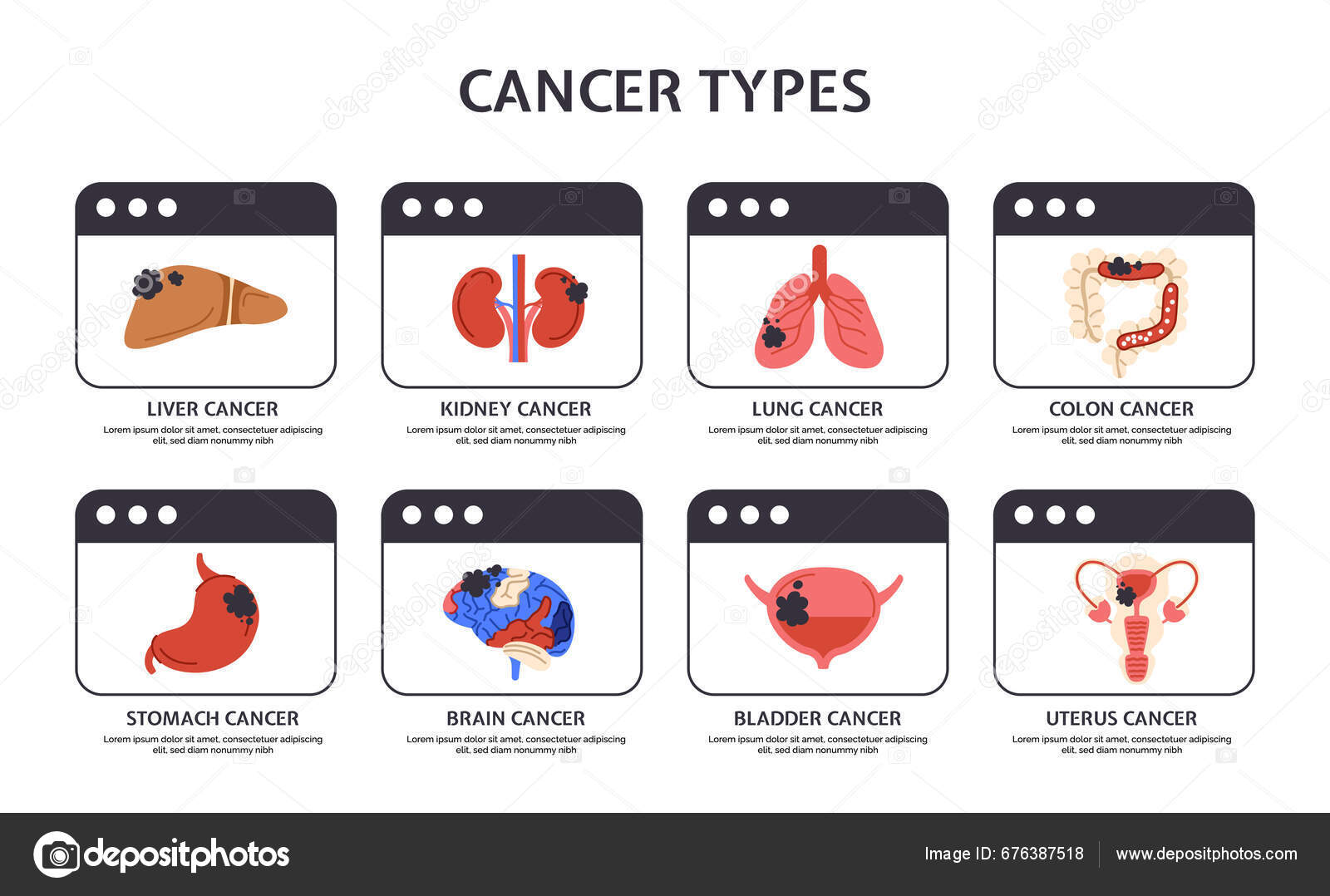 Tipos Conceito Câncer Infográficos Médicos Materiais Educacionais ...