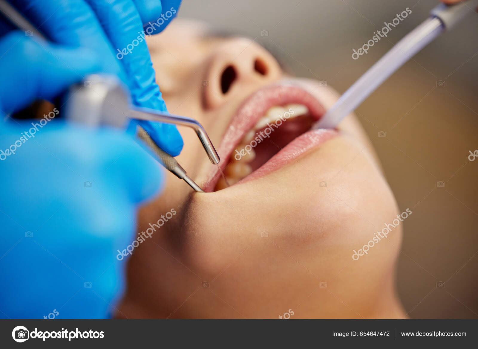 How Healthy Teeth Crafted Young Woman Having Dental Procedure Performed ...