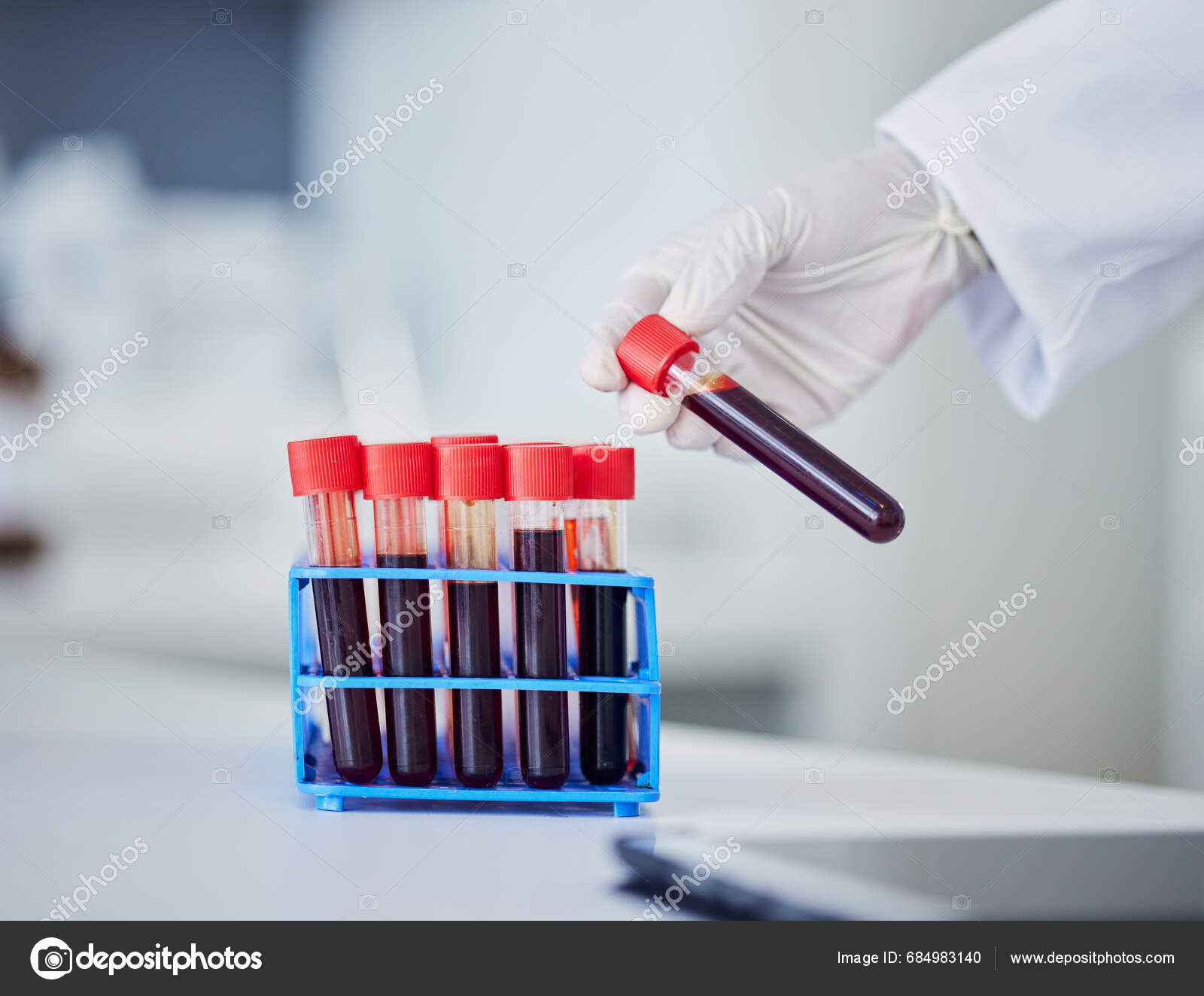 Ciencia Sangre Manos Con Probeta Laboratorio Para Investigación Proceso ...