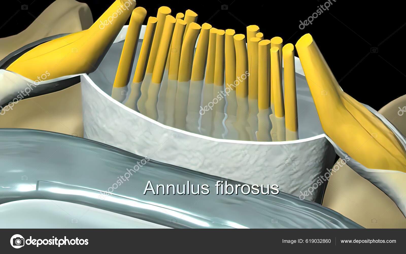Vertebral Compression Fractures Vcfs Occur Bony Block Vertebral Body ...