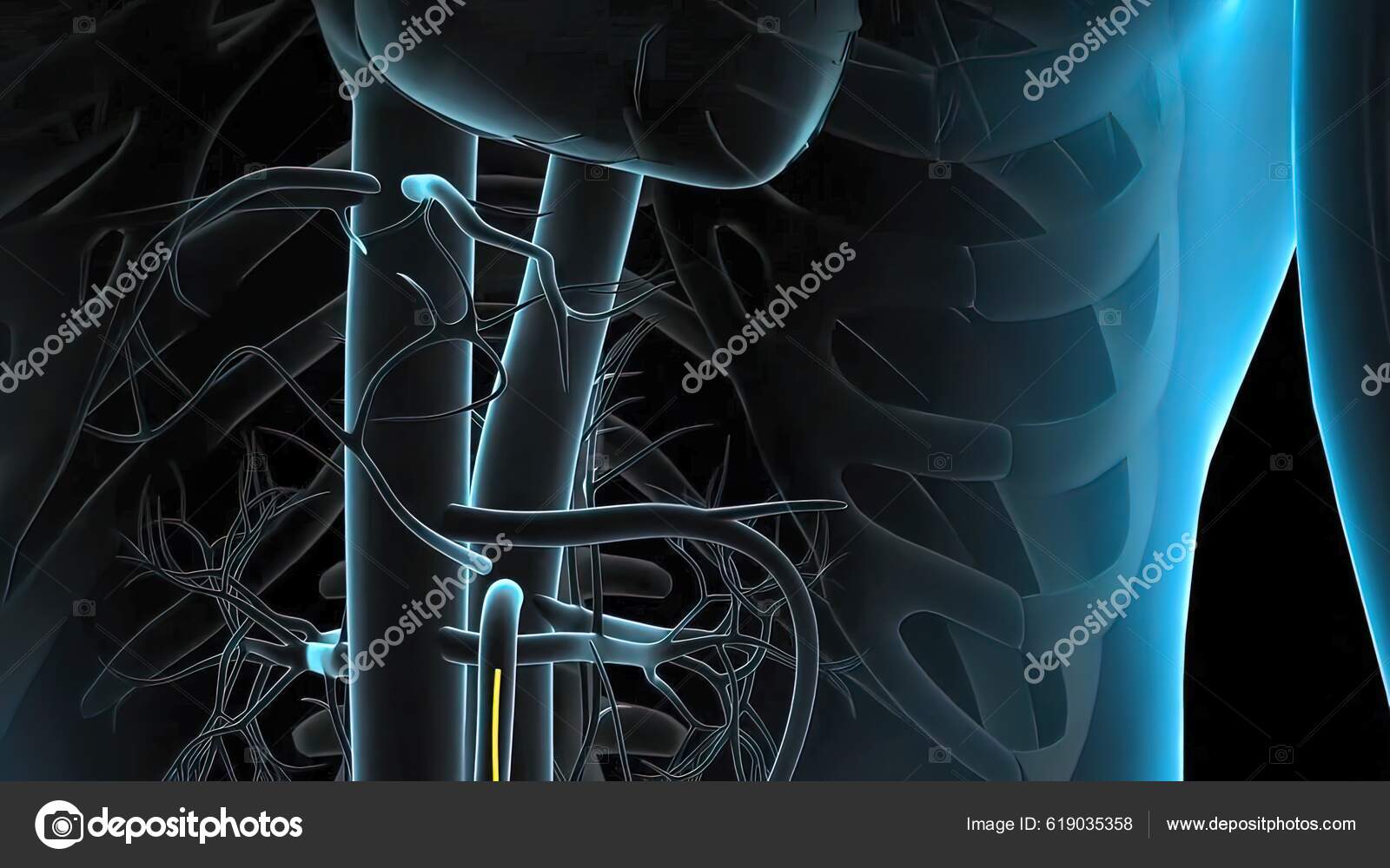 Coronary Stent Small Mesh Tube Used Treat Narrowed Weakened Arteries ...
