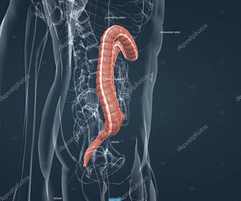 La apendicitis es una inflamación del apéndice, un saco en forma de ...