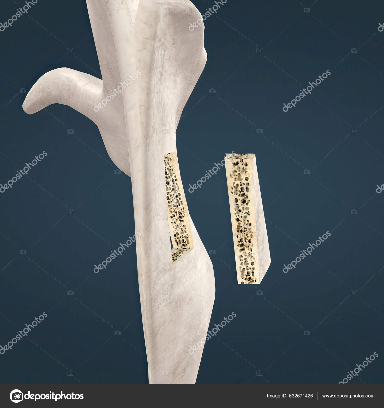 Long Bone Microscopic View Anatomy Illustration Stock Photo by ...