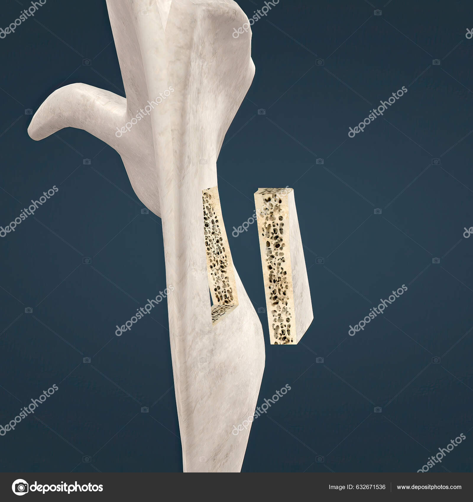 Long Bone Microscopic View Anatomy Illustration Stock Photo by ...