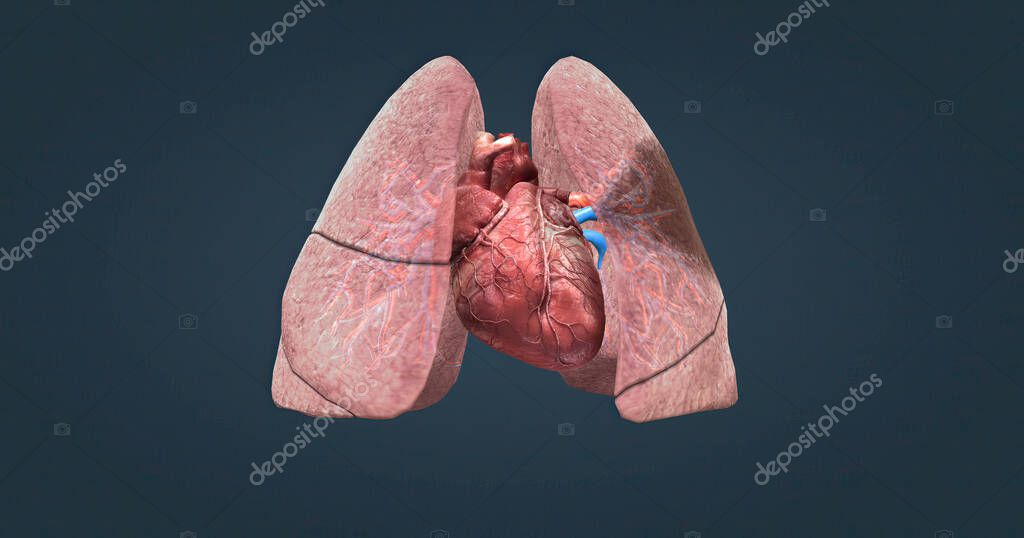 Una embolia pulmonar (EP) ocurre cuando un coágulo de sangre se atasca ...