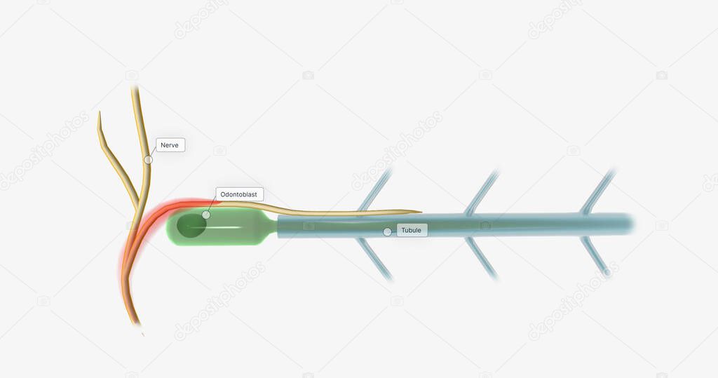 Dentin contains thousands of fluid filled tubules, which are tiny ...