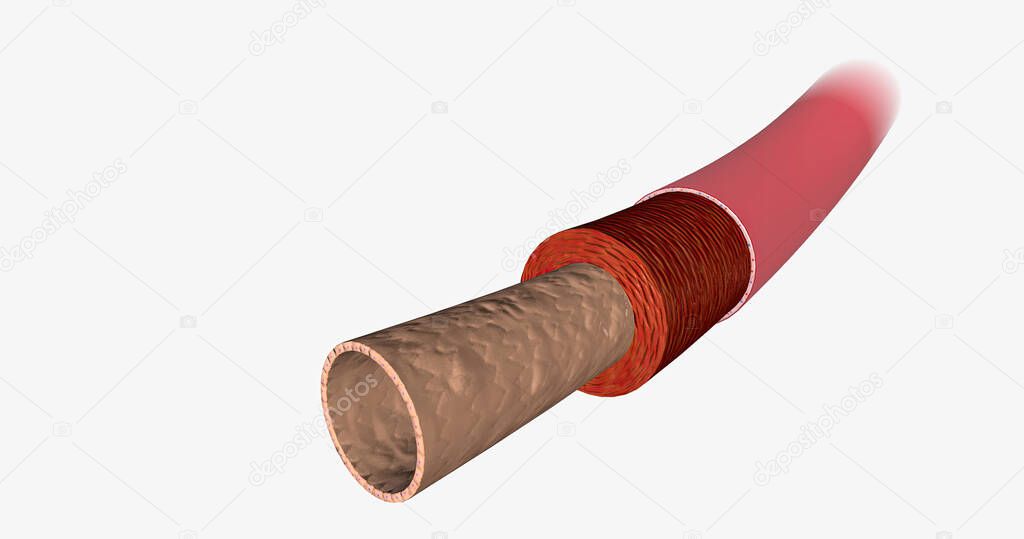 The endothelium is part of the tunica intima, the innermost layer of ...