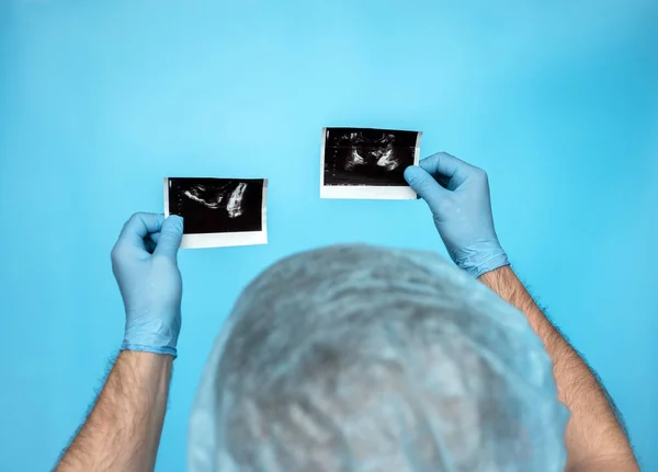 The Doctor Examines The Ultrasound Of Prostate Adenoma In A Man A
