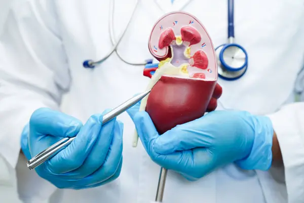 Enfermedad renal cr nica, m dico con modelo para el tratamiento del sistema urinario, urolog a ...