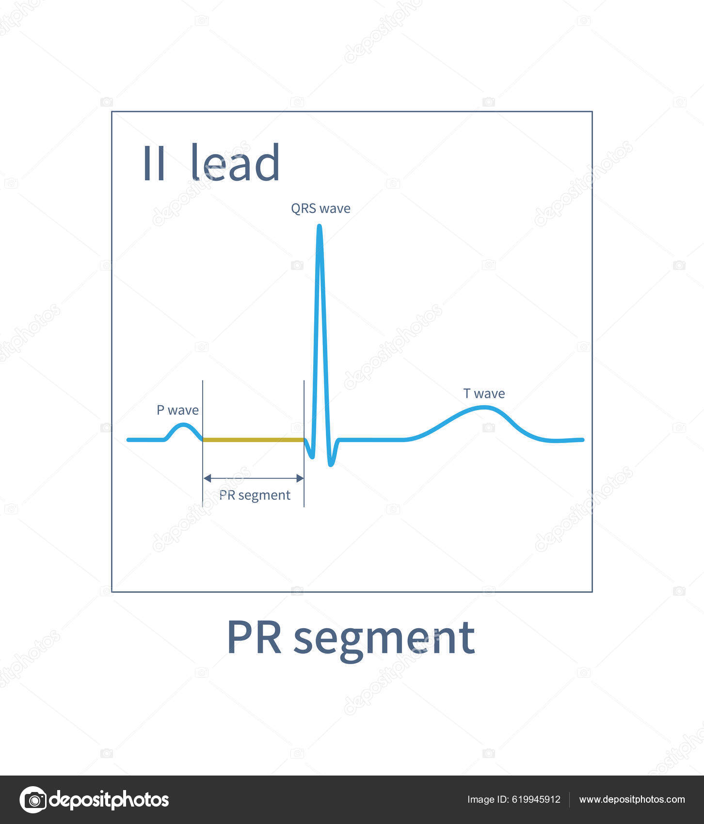 Segment Ecg Segment Located End Point Wave Start Point Qrs Stock Photo ...