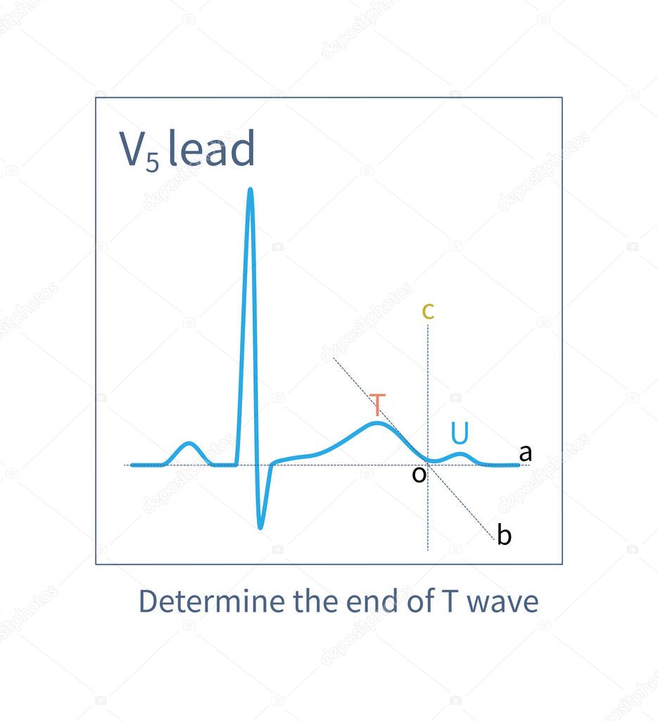 A tangent to the equipotential line is made along the descending branch ...