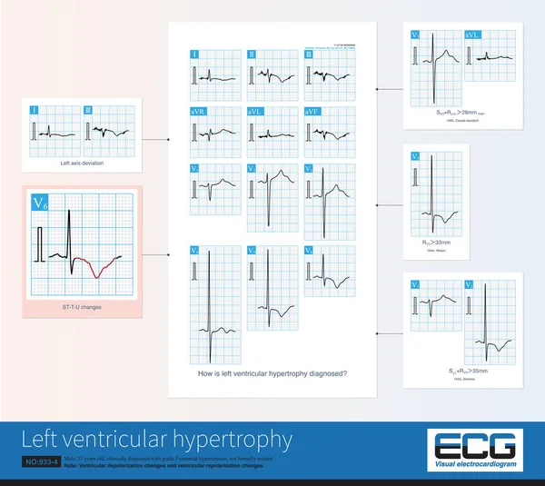 Cardiac changes Stock Photos, Royalty Free Cardiac changes Images ...