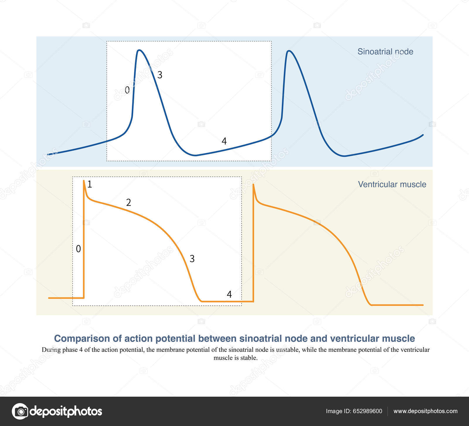 Schrittmacherzellen Sinusknoten Produzieren Spontan Elektrische Impulse ...