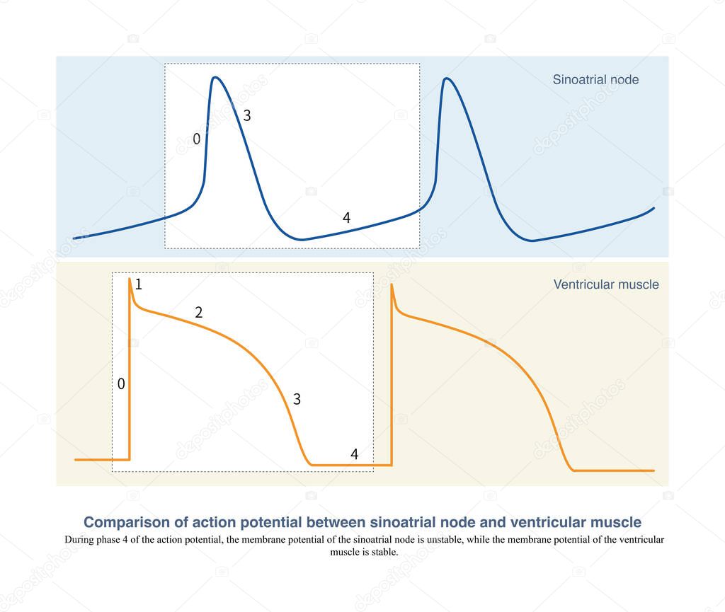 Las células estimulantes en el nodo sinusal producen espontáneamente ...