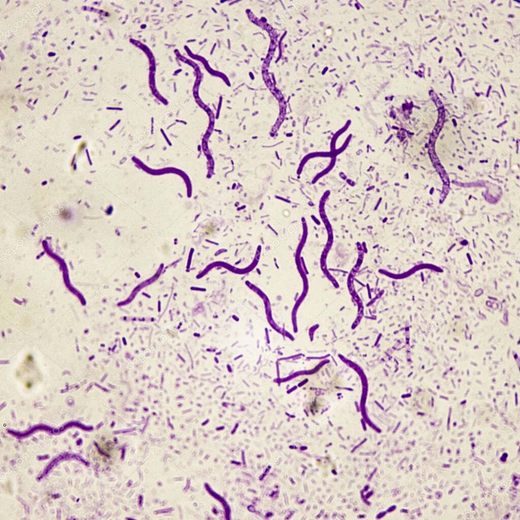 Las espiroquetas rojas carmesí son una bacteria en forma de espiral que ...